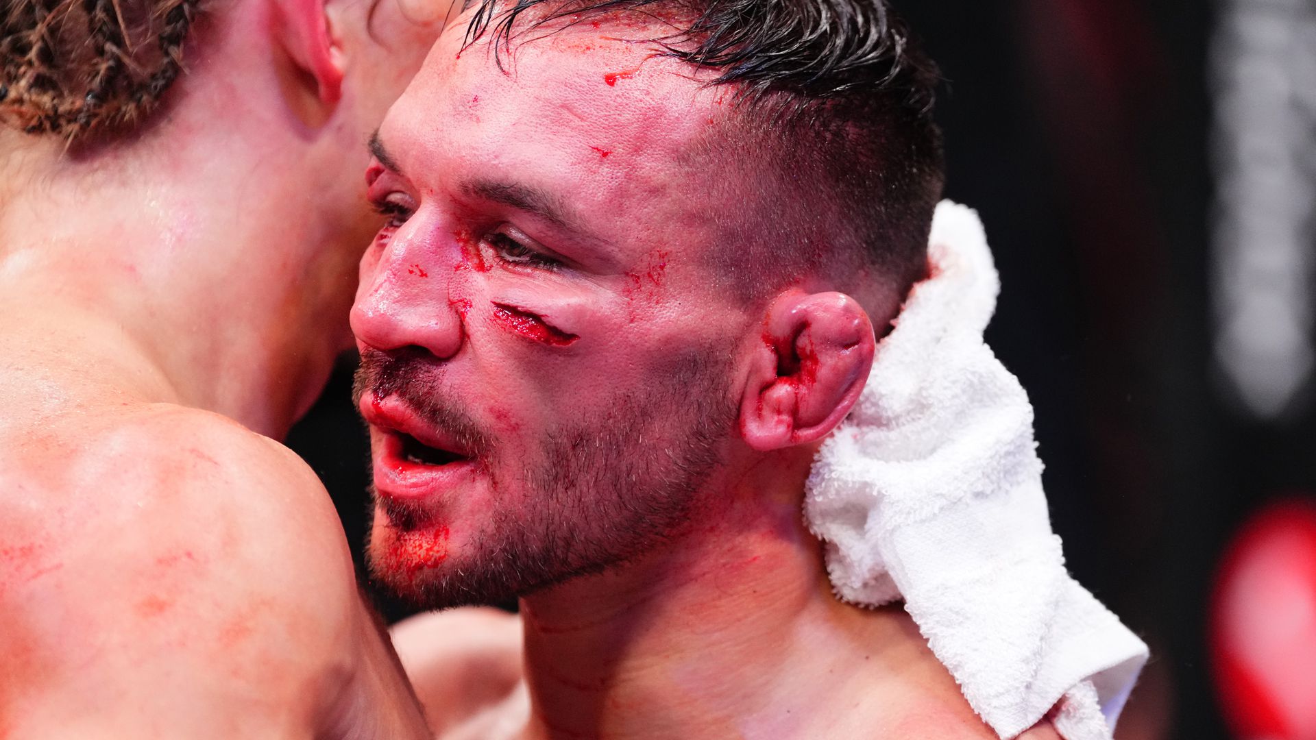 Michael Chandler Finally Opens Up About ‘Baddy’ Beatdown