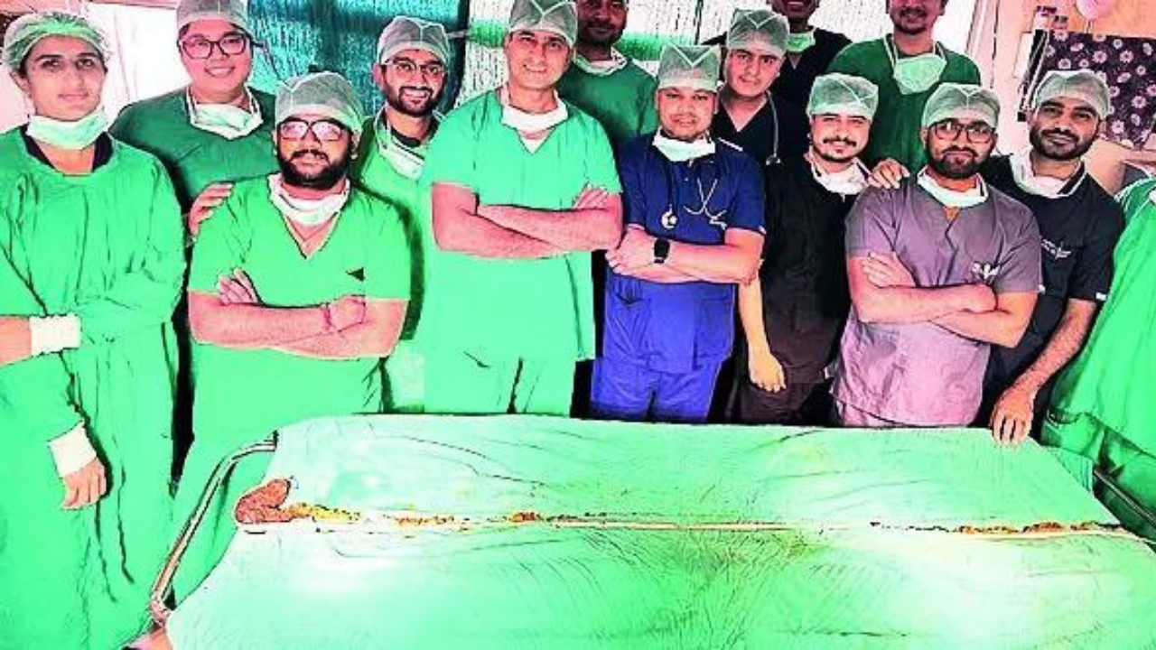 World's longest hairball removed from teen's stomach at SMS Hosp