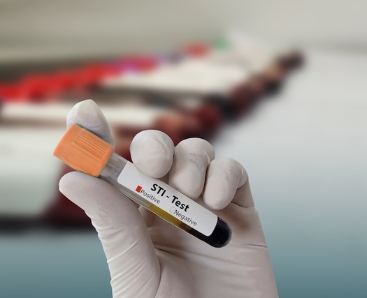 HIV testing, outreach falter in MS amid federal funding cuts