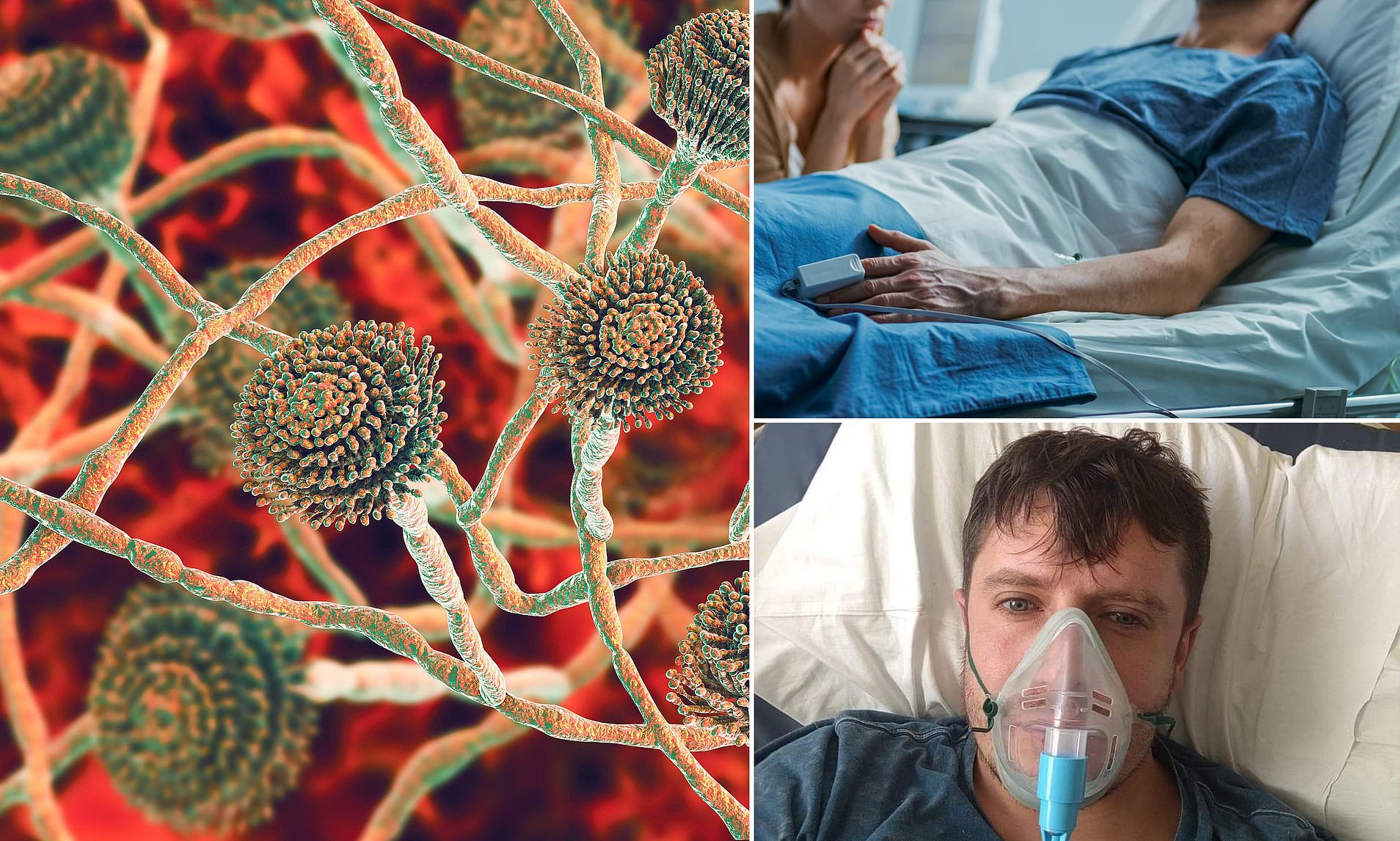 Terrifying alert over rise in lethal fungus experts say is a 'threat to ...