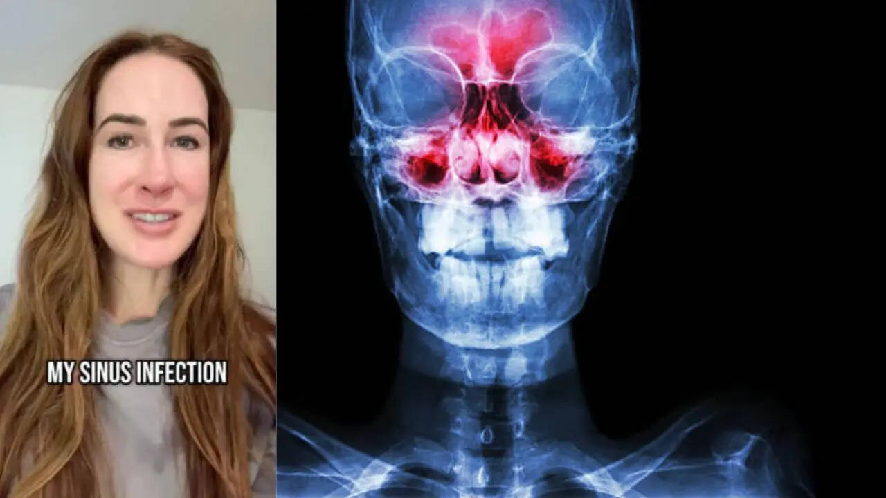 Influencer Says Boyfriend's Fart on Face Gave Her a Deadly E. Coli ...