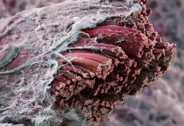 24 Photos of What Random Things Look Like Under A Microscope