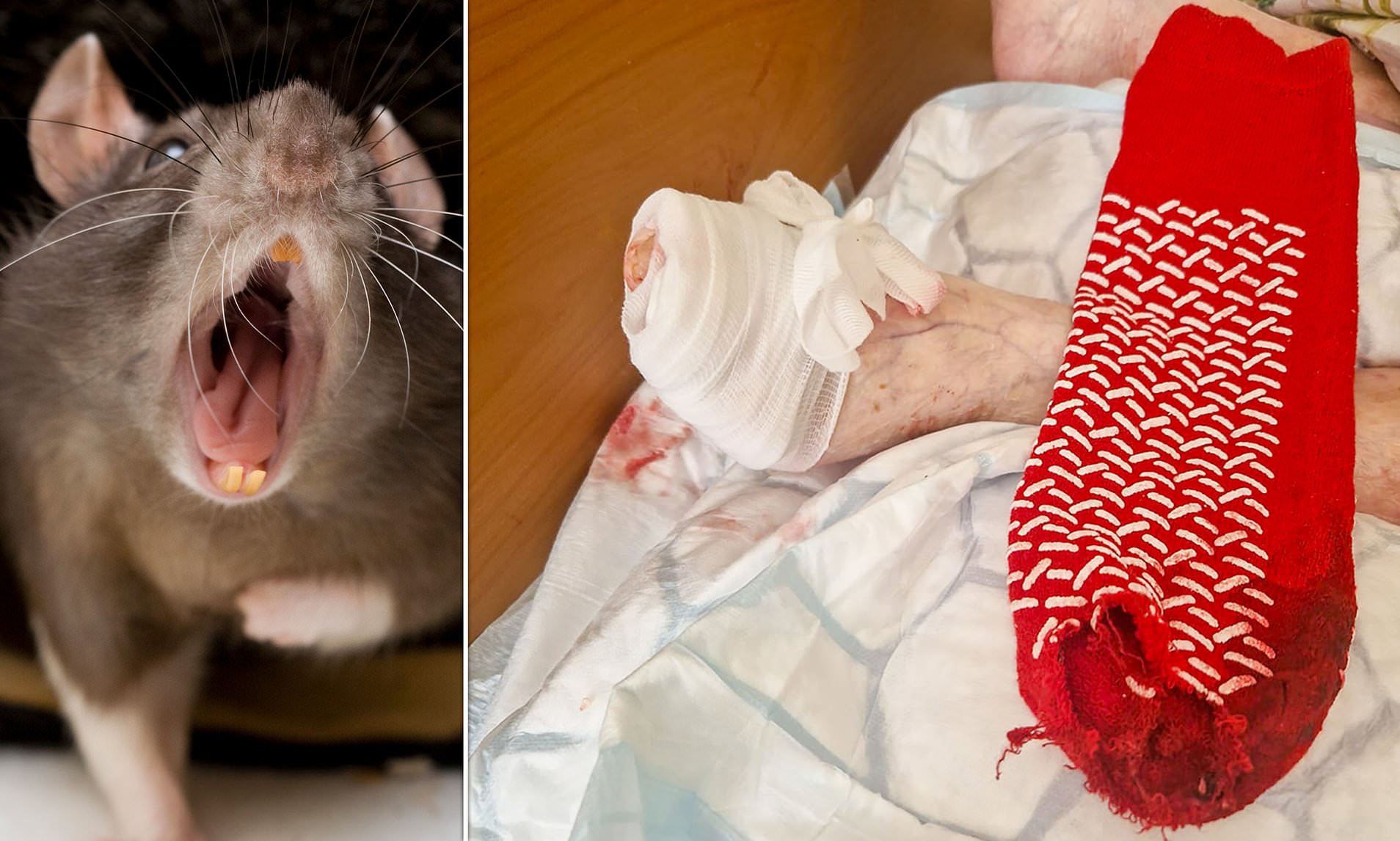 Bedbound pensioner's toe is chewed off by a RAT while waiting for ...