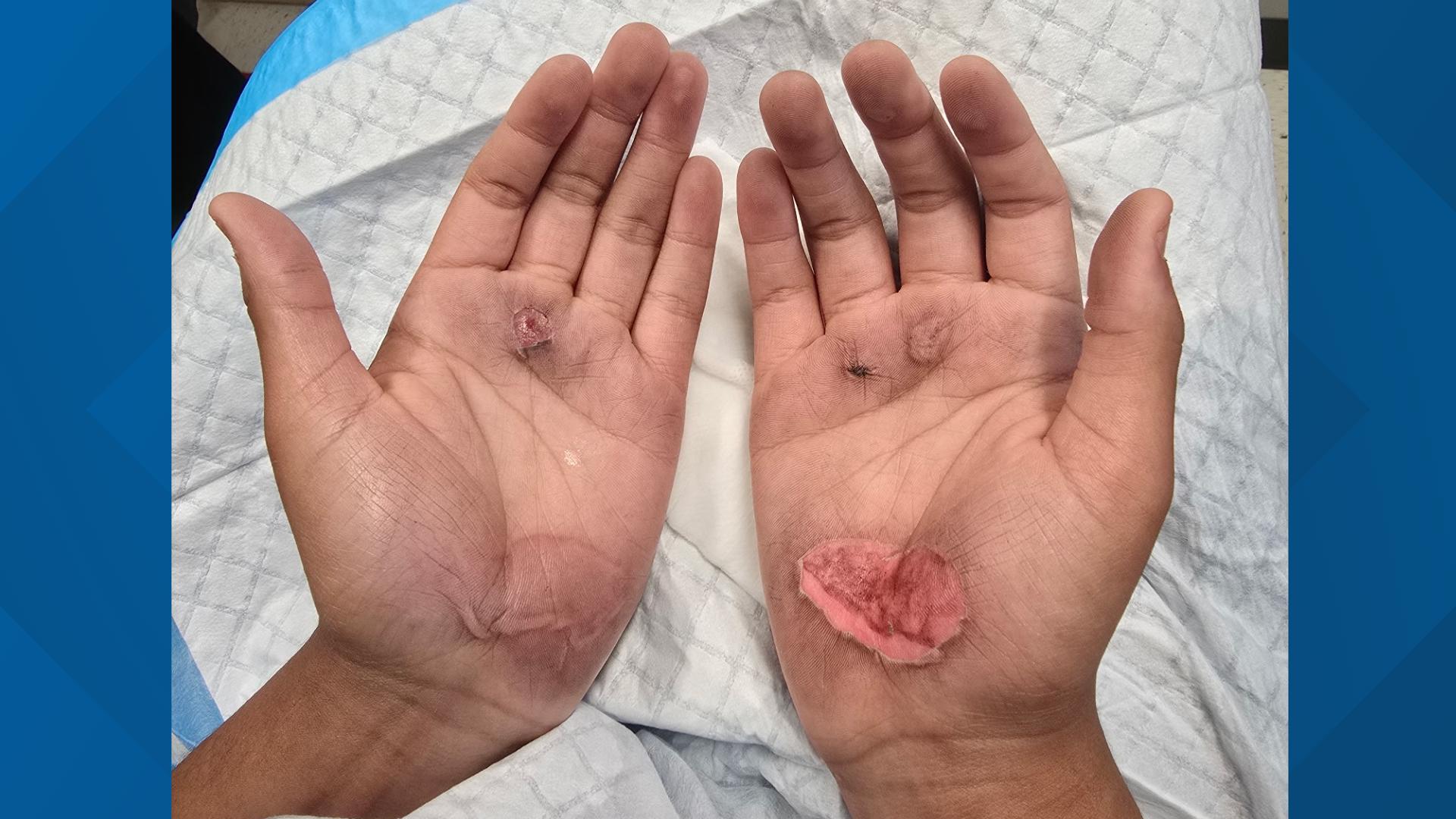 Students injured at East Texas middle school after doing TikTok 'bear ...