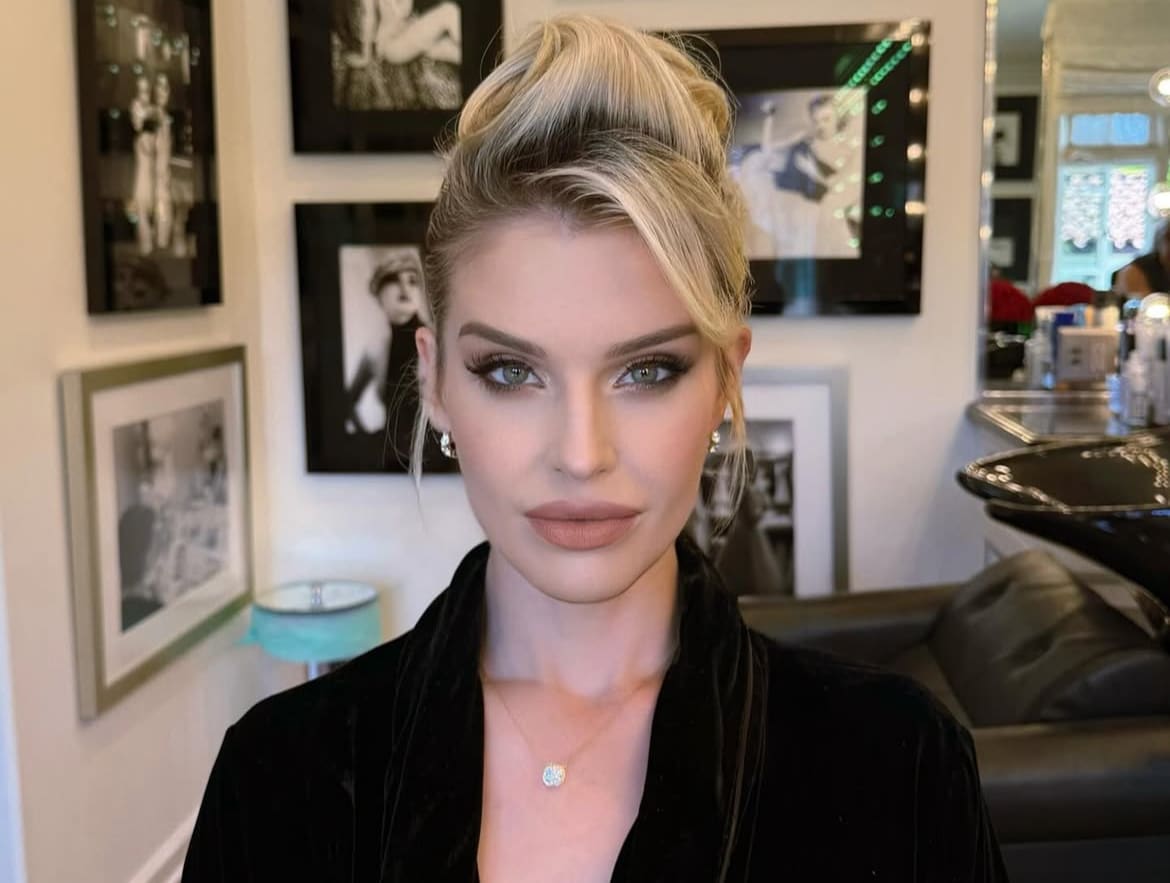 Kelly Osbourne New Face Ignites Ozempic Row — Mum Sharon Also Speaks Out