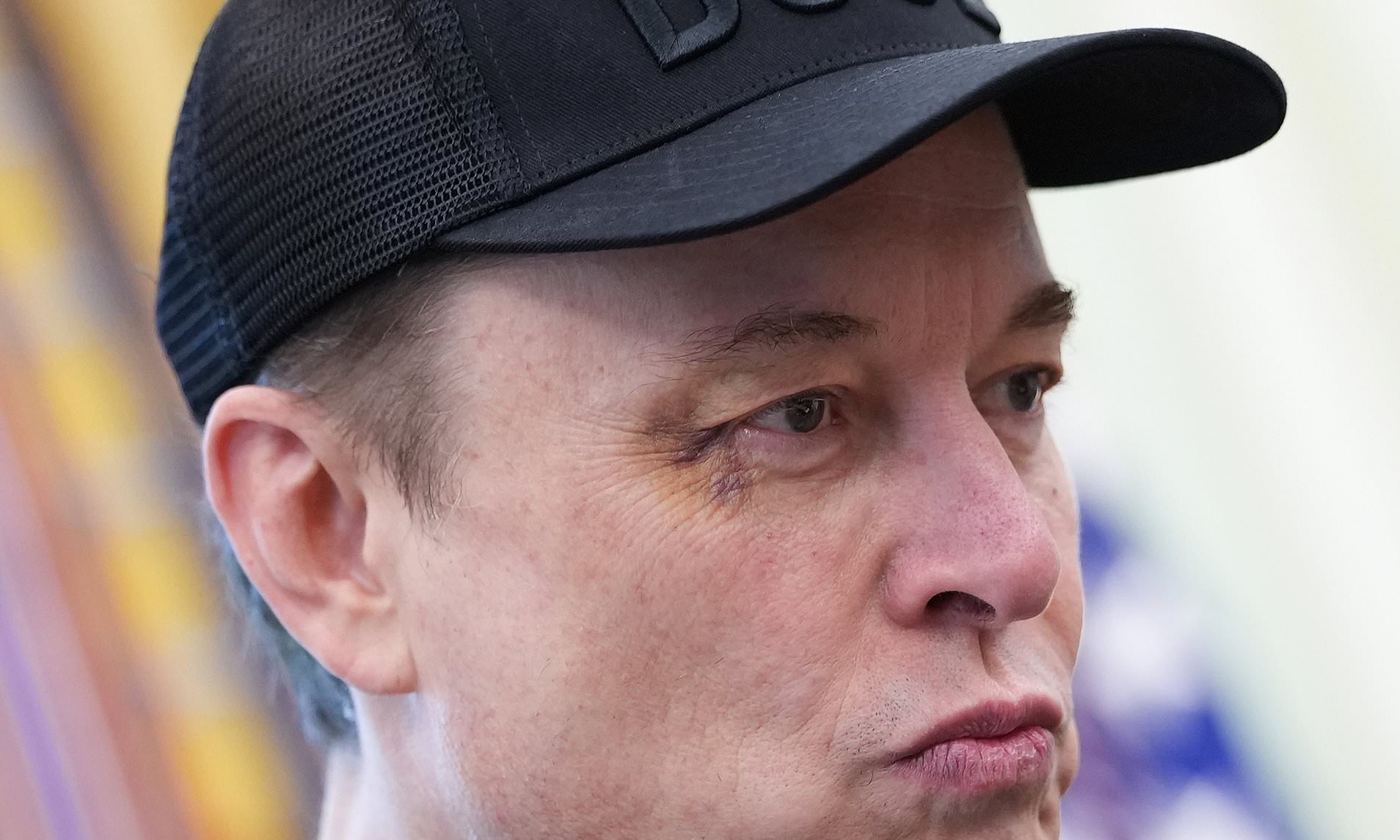 Elon Musk sports BLACK EYE at final White House briefing with Trump ...