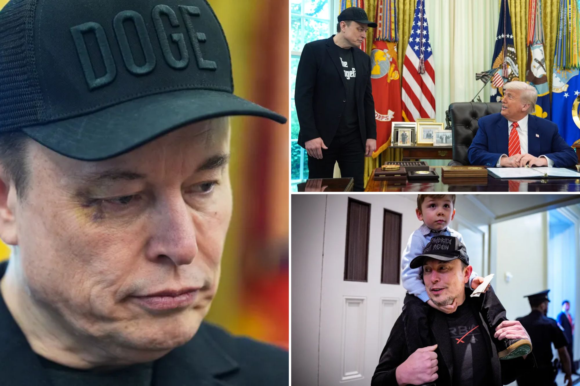 Elon Musk raises concerns after sporting black eye at White House ...