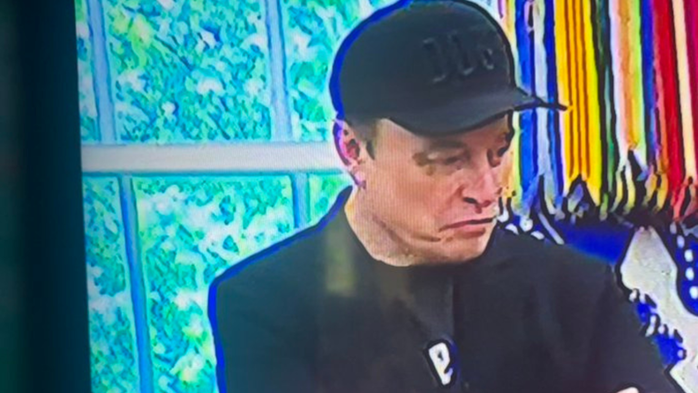 What Happened To Elon Musk's Eyes? Possible 'Black Eye' And 'Bruise' Go ...