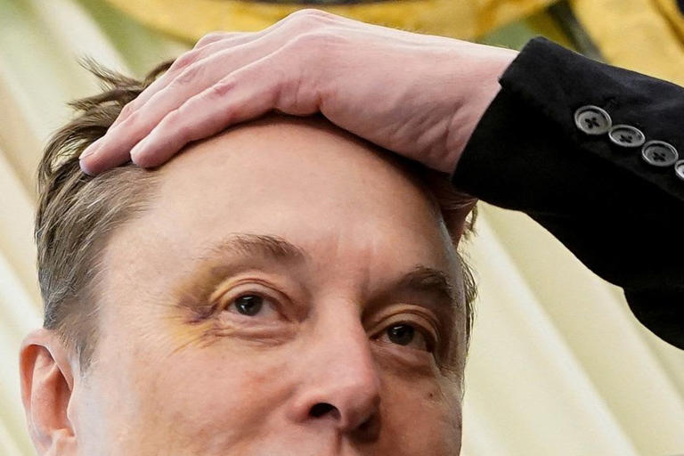 Elon Musk sports BLACK EYE in final White House press conference as he ...