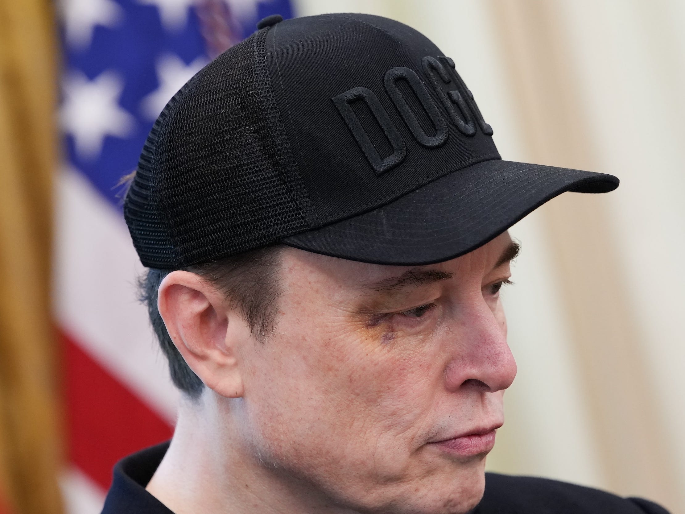 Elon Musk tells the story behind his black eye