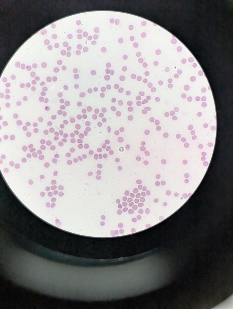 Williamson County veterinary clinic warns cat owners of deadly Bobcat Fever