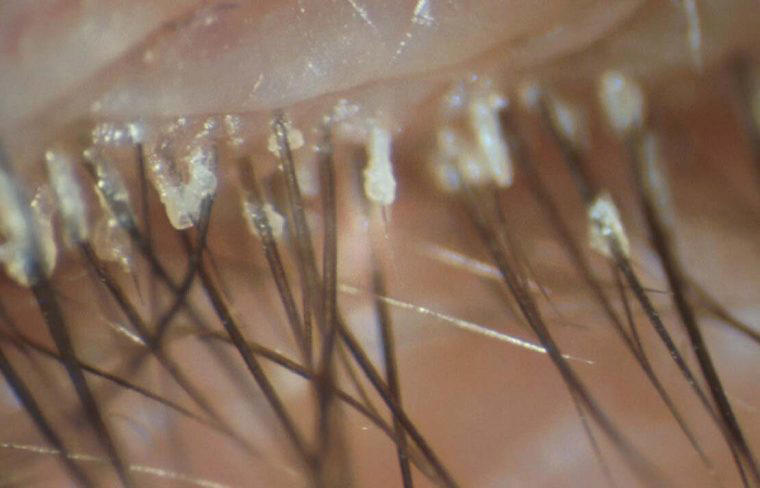 The disgusting reason you must wash your sheets at 60°C