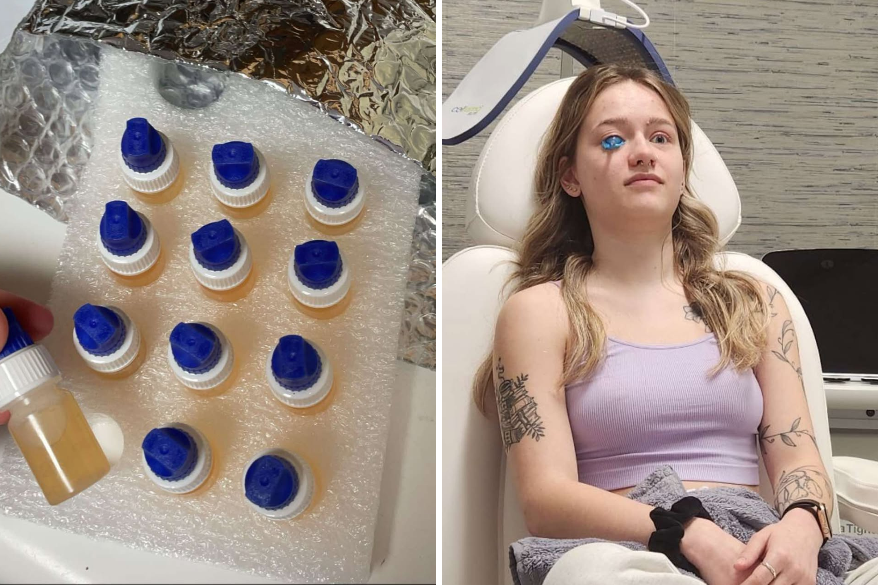 Doctors said my eyes were just dry—now I live with a devastating disability