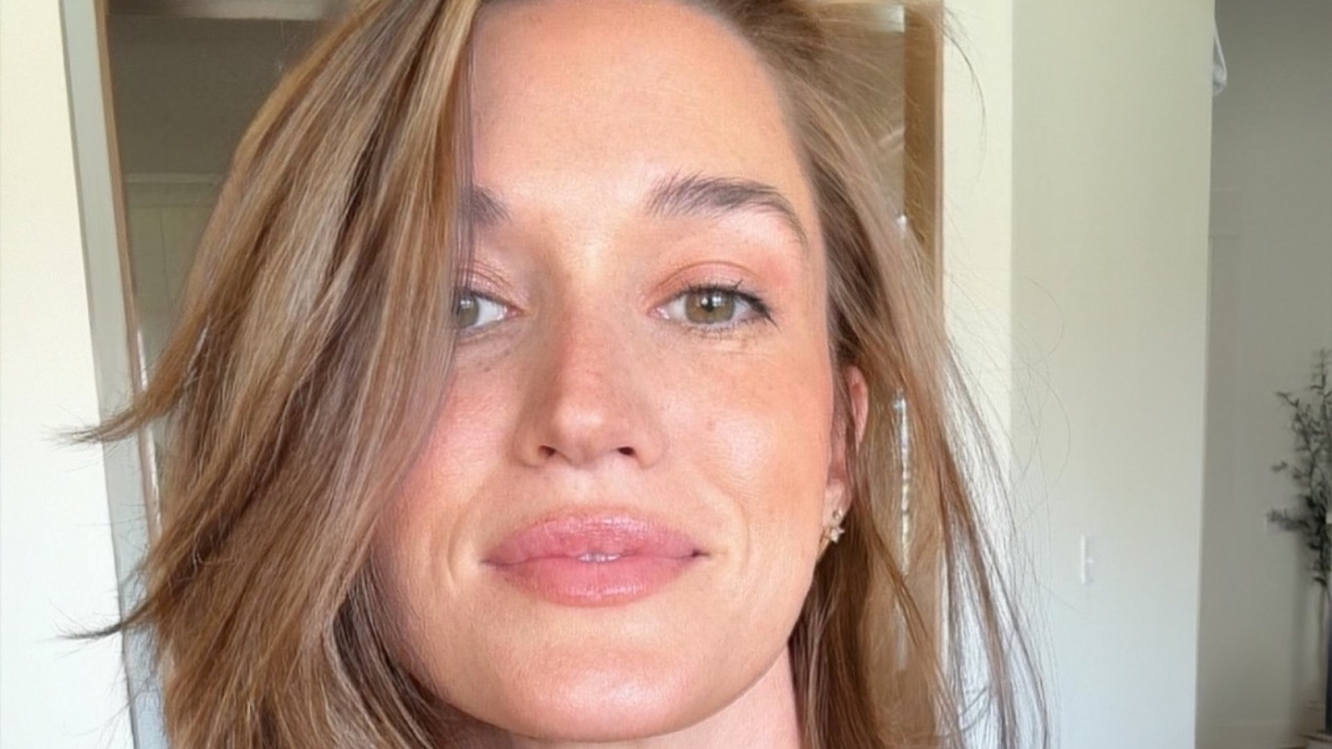 Bachelor Nation Alum Jade Roper Says She Has Benign Pilar Cyst on Her Scalp