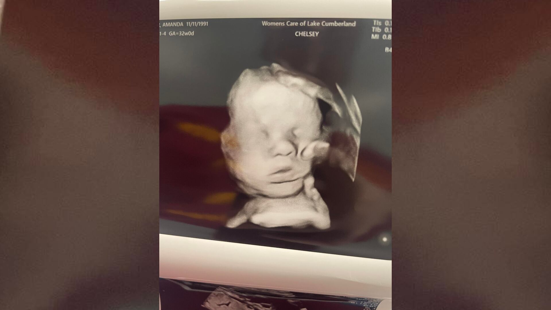 “The Hand of God”: Kentucky mom sees divine sign in baby’s ultrasound