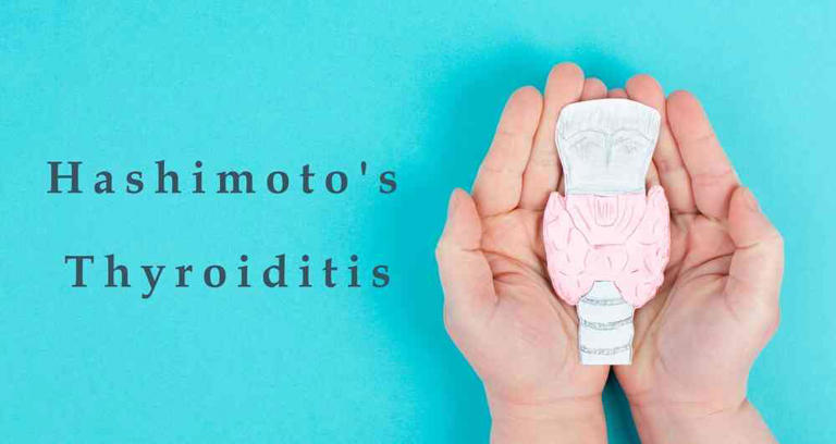 Hashimoto's Thyroiditis: Causes, Symptoms, Diagnosis and Treatment