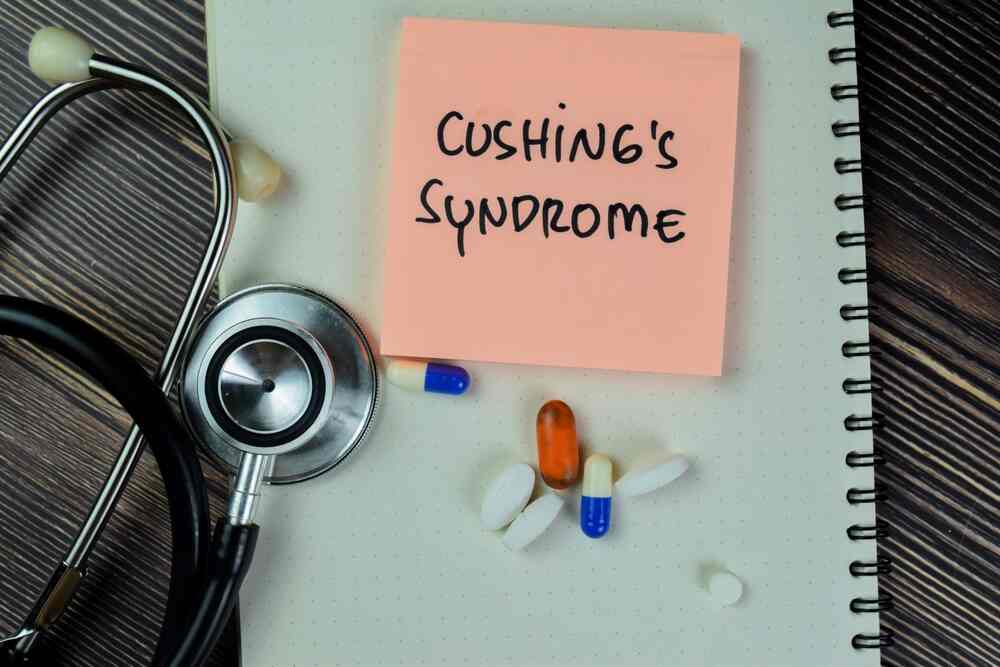 Cushings Syndrome: Meaning, Causes, Symptoms and Treatment