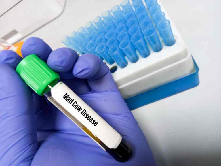 Mad Cow Disease and vCJD: Symptoms, Diagnosis, Treatment, and Prevention