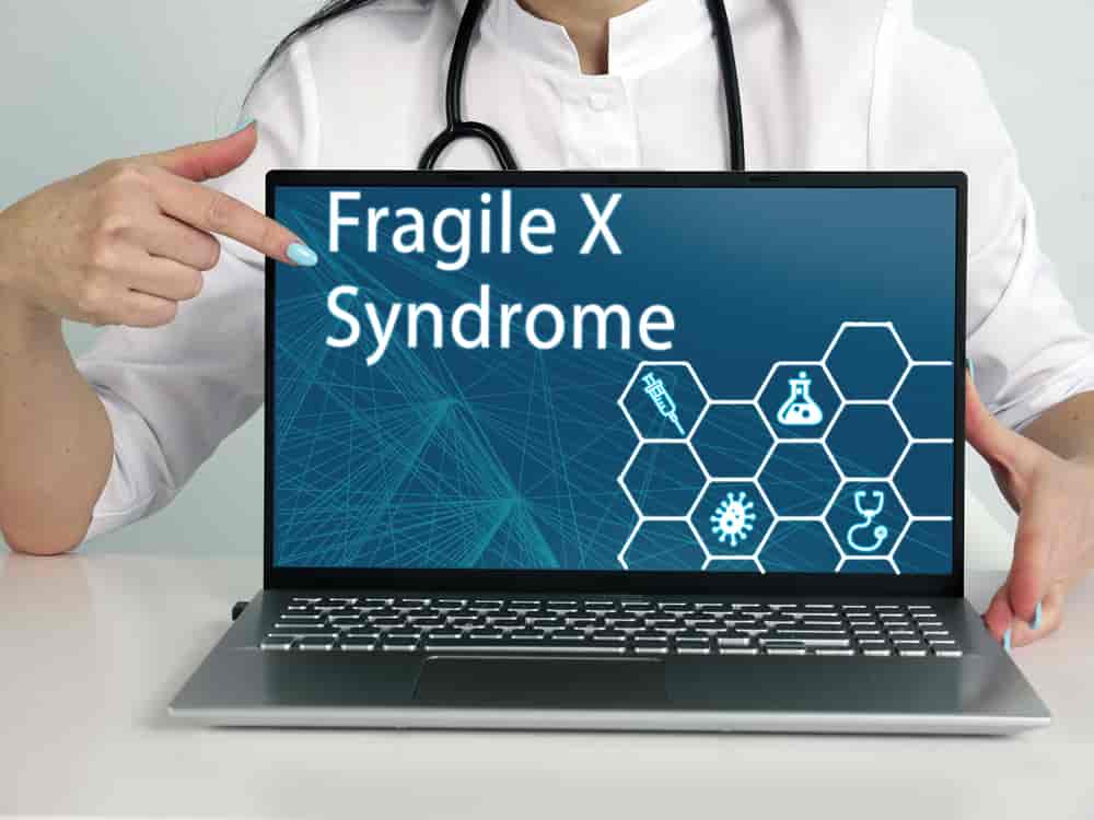 Fragile X Syndrome: Symptoms, Diagnosis, Treatments and Complications