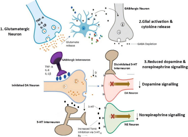 Neurosteroids identified as potential therapy for treatment-resistant ...