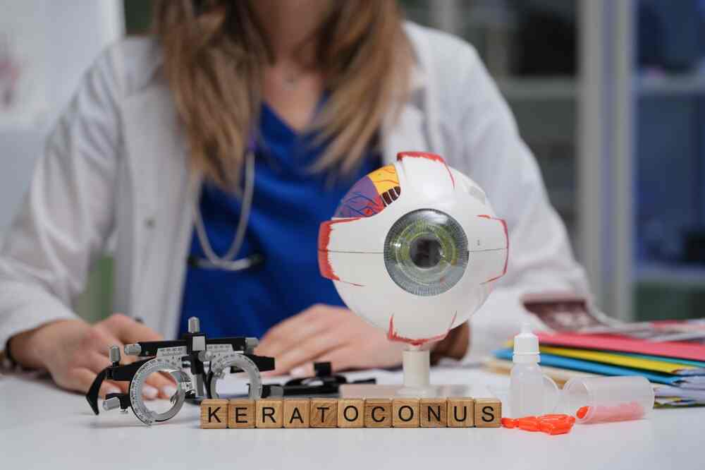 Keratoconus: Causes, Symptoms, Diagnosis and Treatment