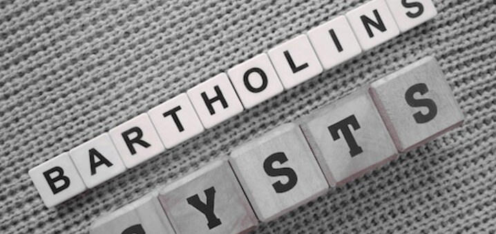 Bartholin's Cyst: Symptoms, Diagnosis, Treatment and Prevention