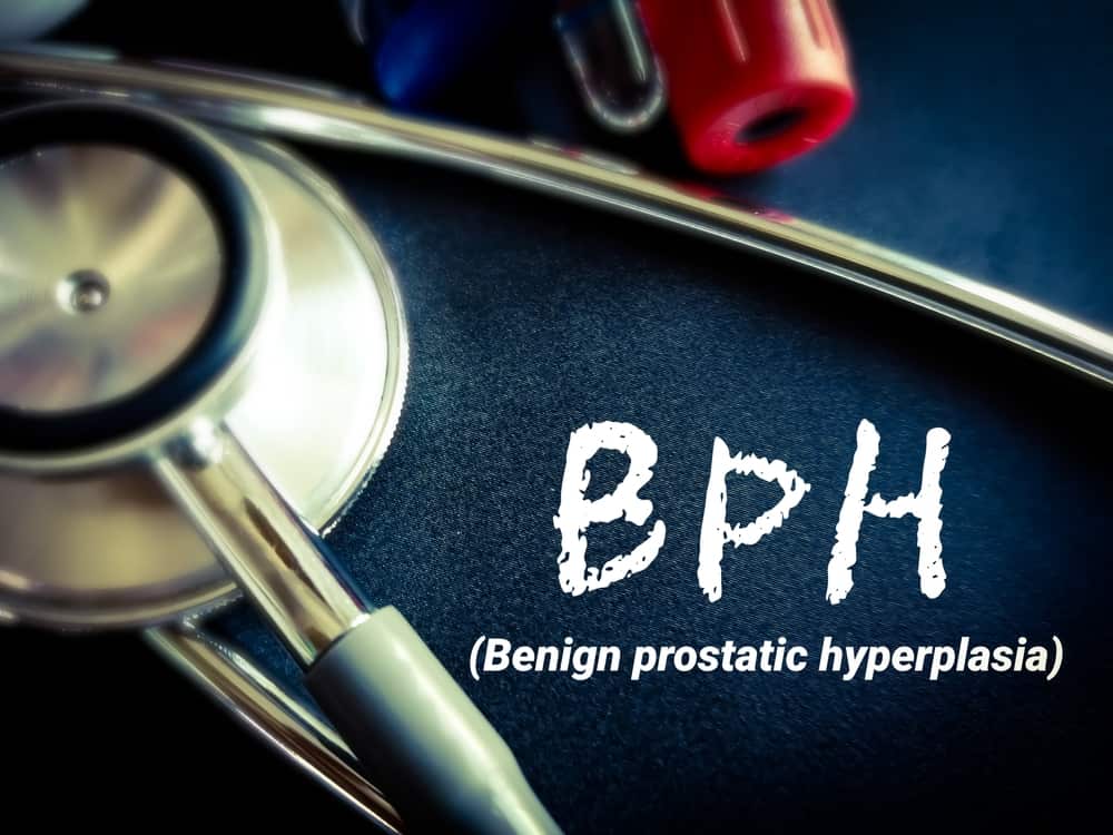 Benign Prostatic Hyperplasia: Causes, Symptoms, Diagnosis, and Treatments