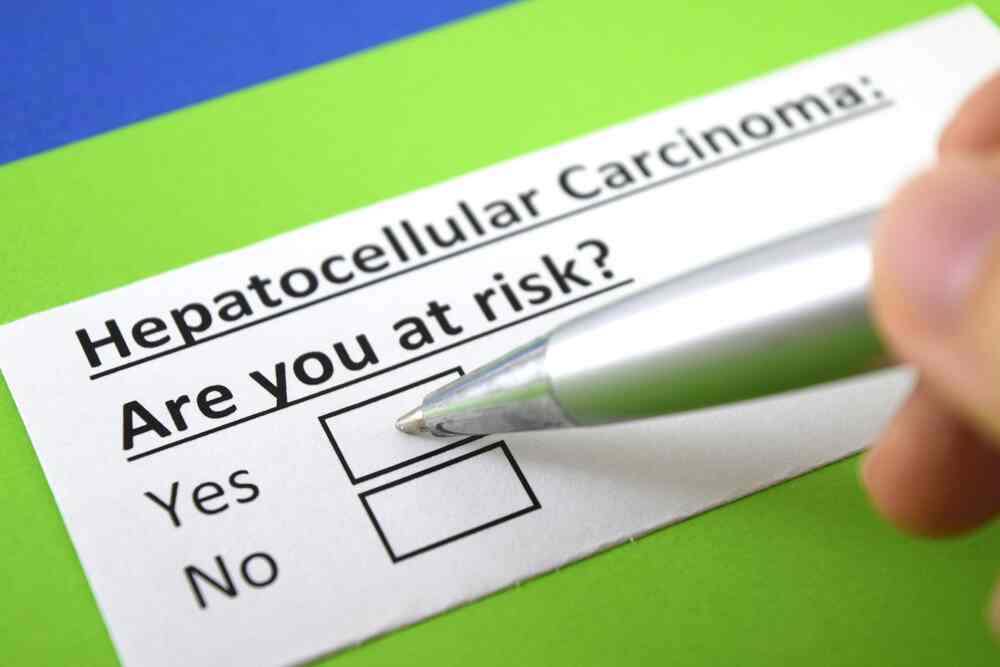 Hepatocellular Carcinoma: Causes, Symptoms and Treatments