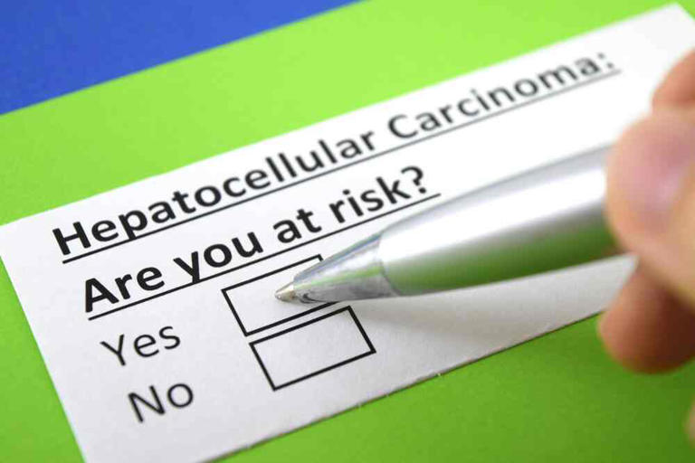 Hepatocellular Carcinoma: Causes, Symptoms and Treatments