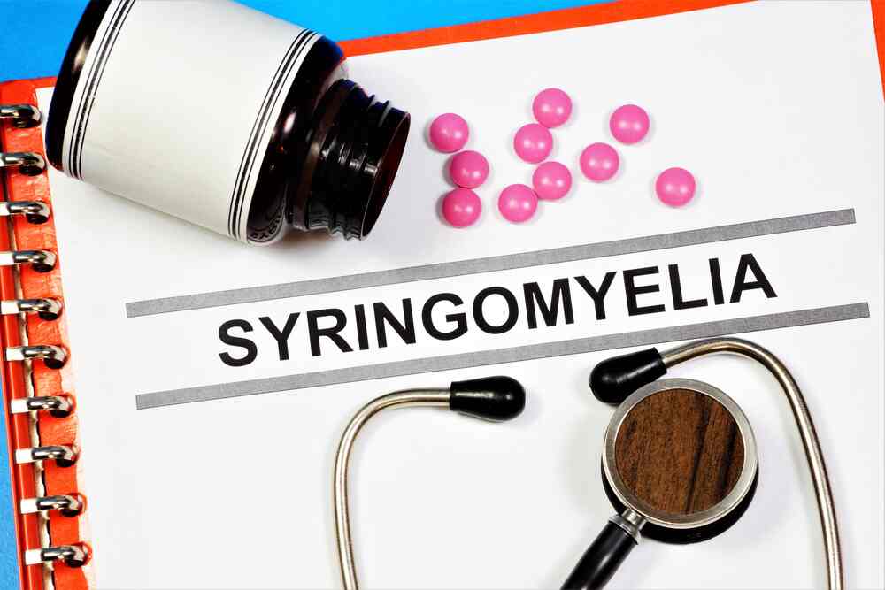 Syringomyelia: Meaning, Symptoms, Causes and Treatment