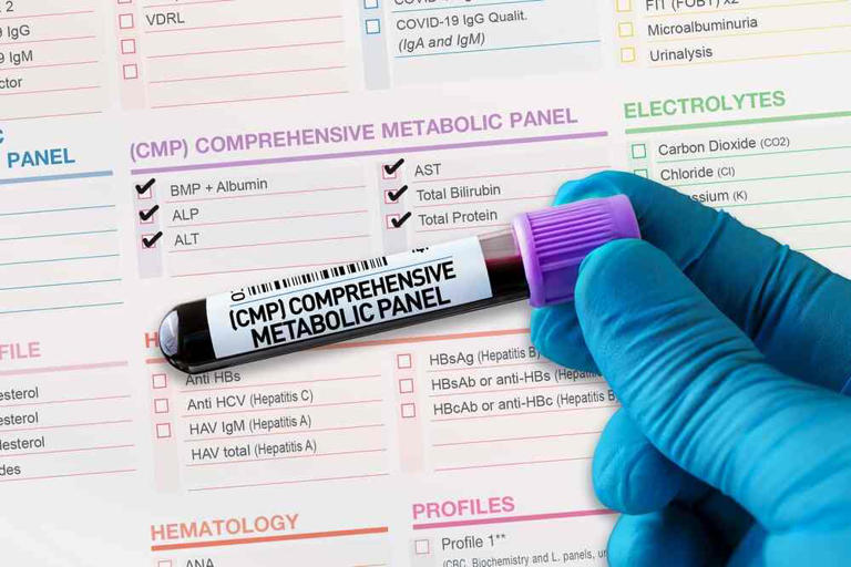 Step-by-Step Guide to Comprehensive Metabolic Panel Procedure