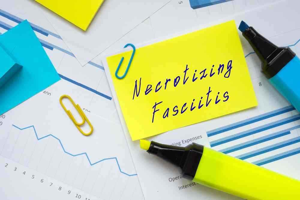 Necrotizing Fasciitis: Types, Causes, Symptoms, Treatment and Prevention