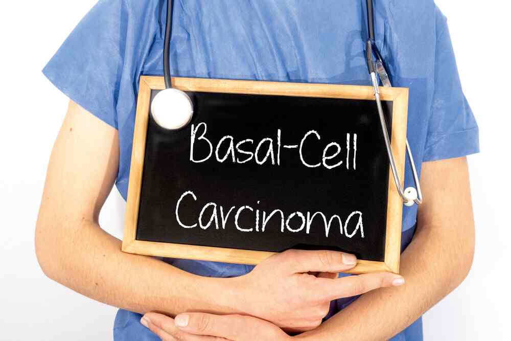 Basal Cell Carcinoma: Causes, Symptoms, Diagnosis and Treatment