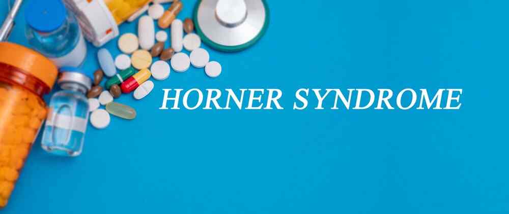 Horner Syndrome: Symptoms, Causes, Diagnosis, Treatment and Prevention