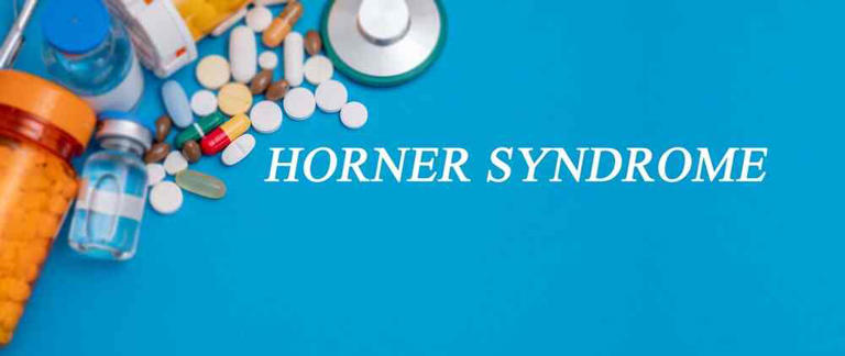 Horner Syndrome: Symptoms, Causes, Diagnosis, Treatment and Prevention