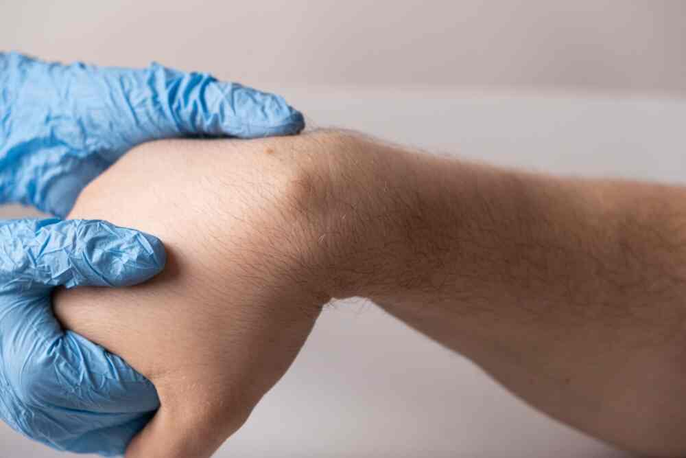 Skin Cysts or Something Else? A Guide to Bumps, Lumps, and Growths