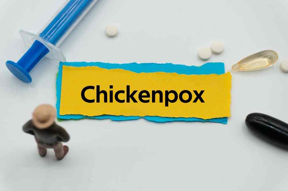 Chickenpox: Causes, Symptoms, Diagnosis, Treatment, Remedies and Prevention