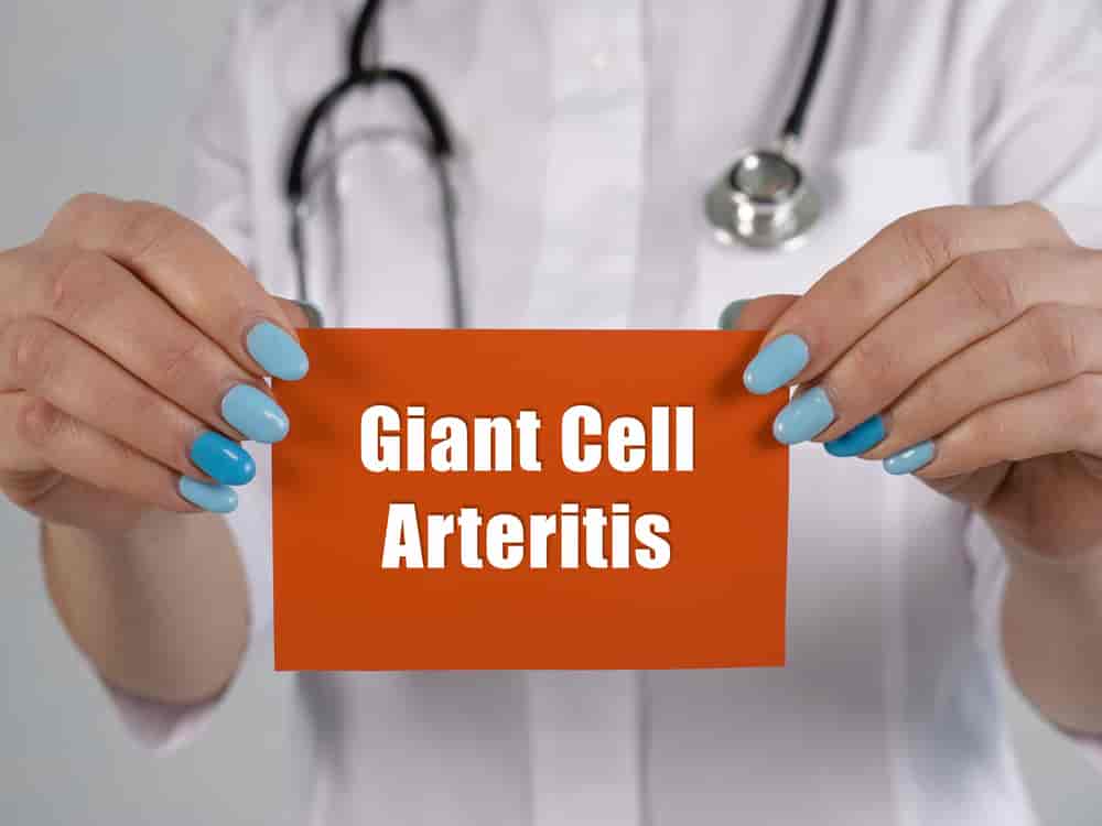 Giant Cell Arteritis: Causes, Symptoms, Diagnosis and Treatment