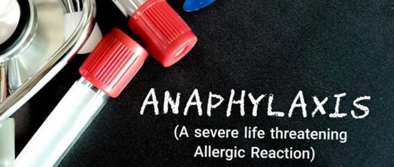 Anaphylaxis and Allergies: Stages, Symptoms, Causes, Treatment and ...