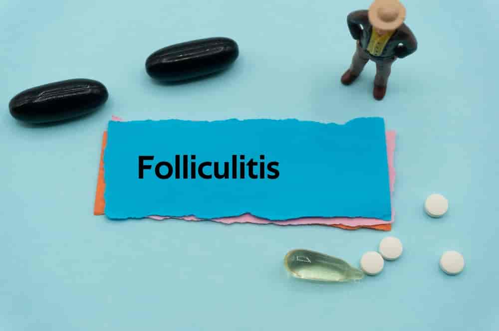 Folliculitis: Symptoms, Causes, Diagnosis, Treatment and Prevention