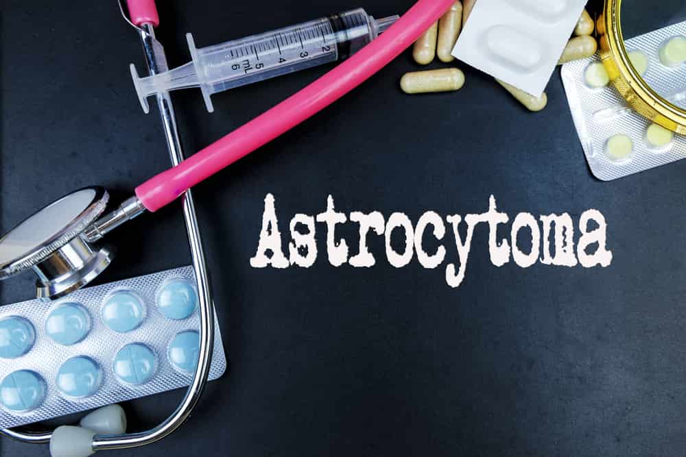 Astrocytoma: Types, Symptoms and Treatment