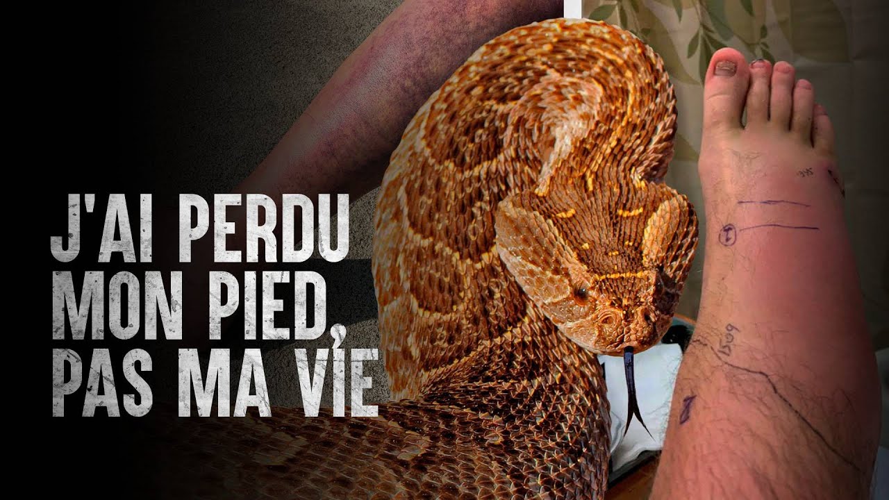 Les 5 morsures de serpent les plus dangereuses