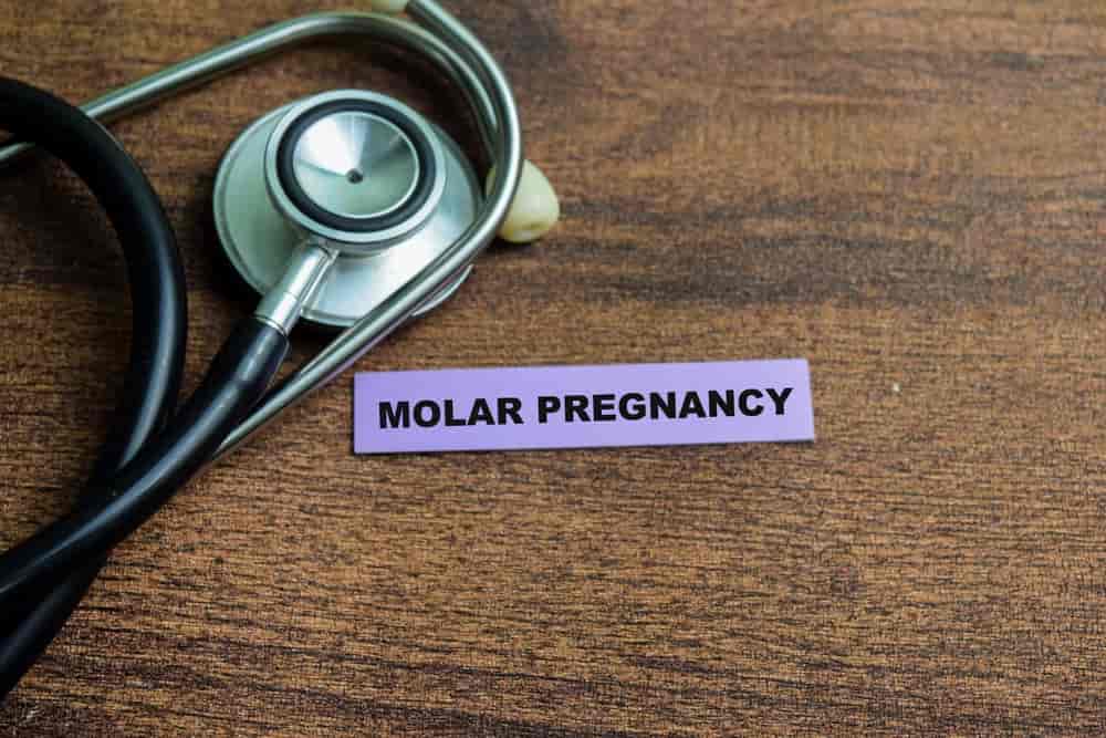 Molar Pregnancy: Types, Causes, Symptoms, Diagnosis, Treatment, and ...