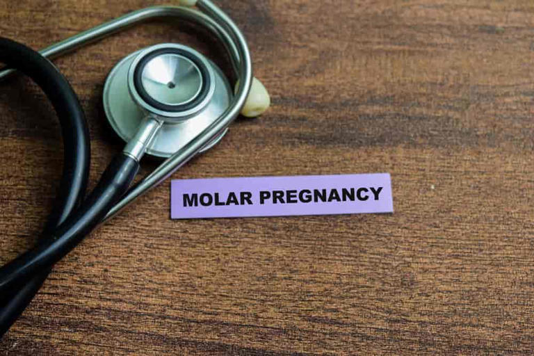 Molar Pregnancy: Types, Causes, Symptoms, Diagnosis, Treatment, and ...