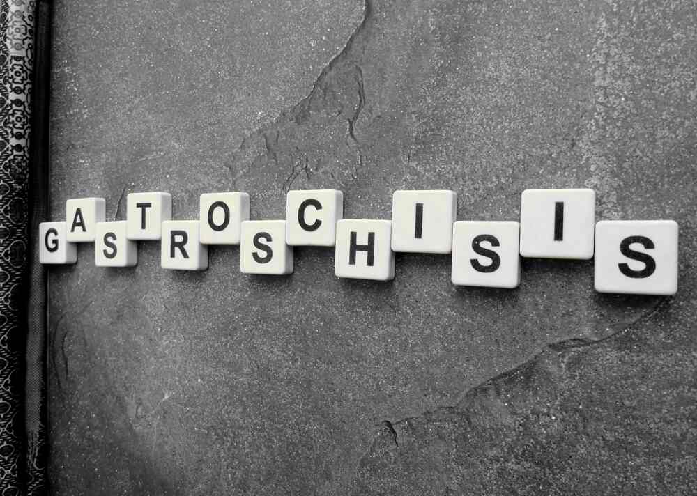 Gastroschisis: Causes, Symptoms, Diagnosis, Treatment and Prevention