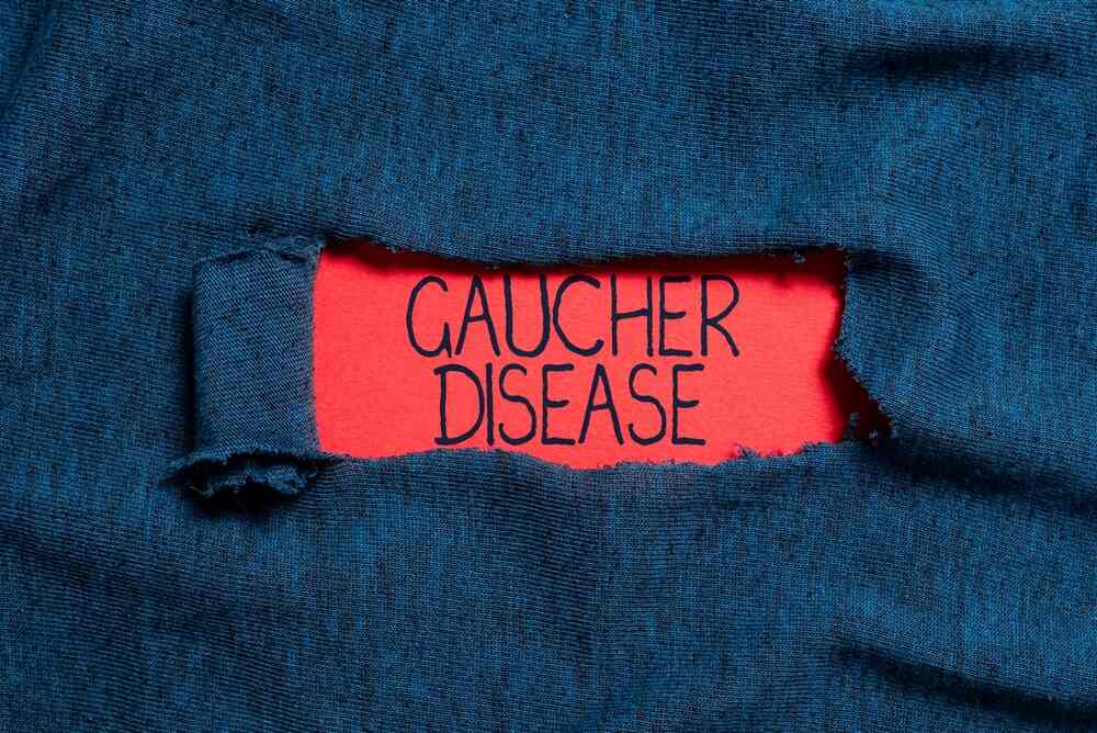 Gaucher Disease: Causes, Symptoms, Diagnosis and Treatment