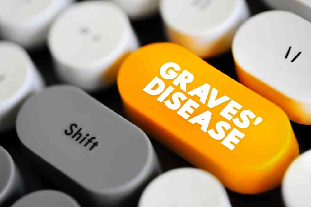 Graves' Disease: Causes, Symptoms, Diagnosis and Treatment