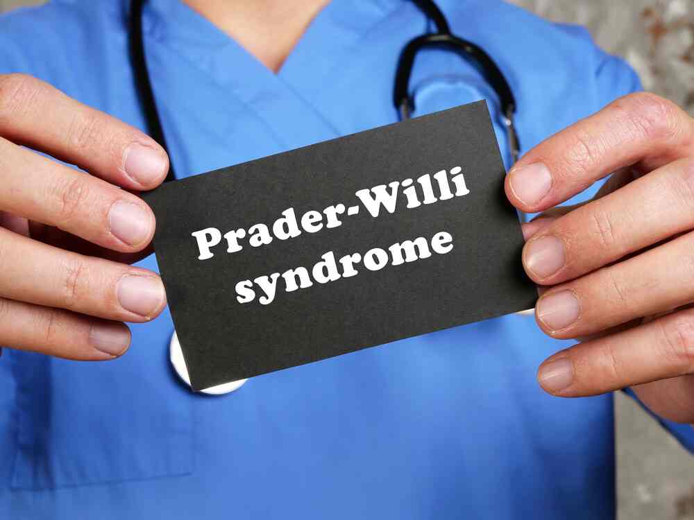 Prader-Willi Syndrome: Causes, Symptoms, Diagnosis, and Treatments