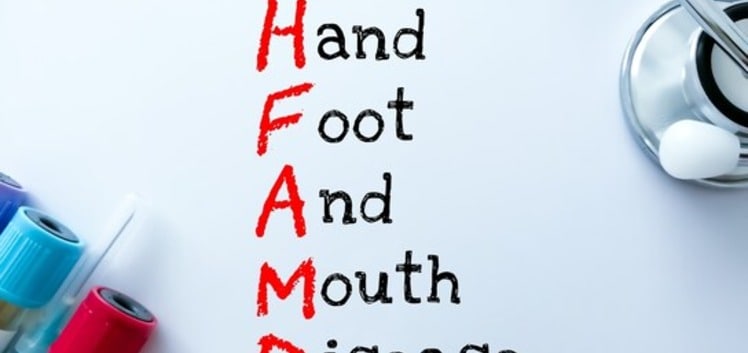 Hand, Foot and Mouth Disease (HFMD): Causes, Stages, Symptoms ...