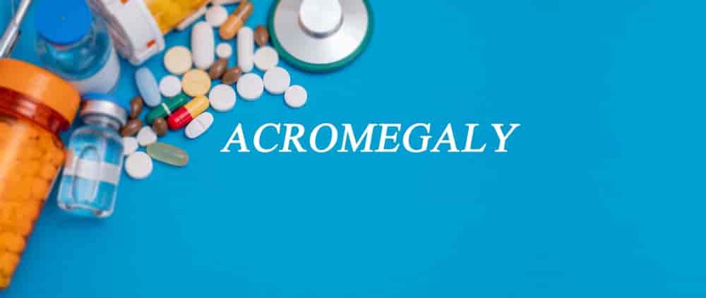 Acromegaly: Causes, Symptoms, Diagnosis and Treatments